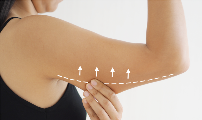 Parxal Arms Patch Reviews - Don't Buy Until You Read This!