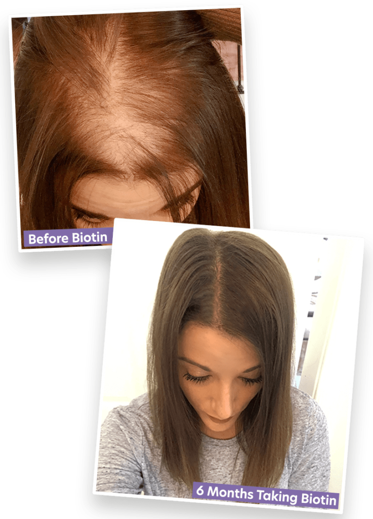 Complete Biotin Plus Ingredients | Nuvectra Medical