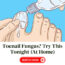 Garlic for Toenail Fungus: The Natural Remedy You Need to Try
