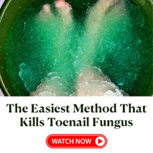 Toothpaste For Toenail Fungus: Can It Really Help?