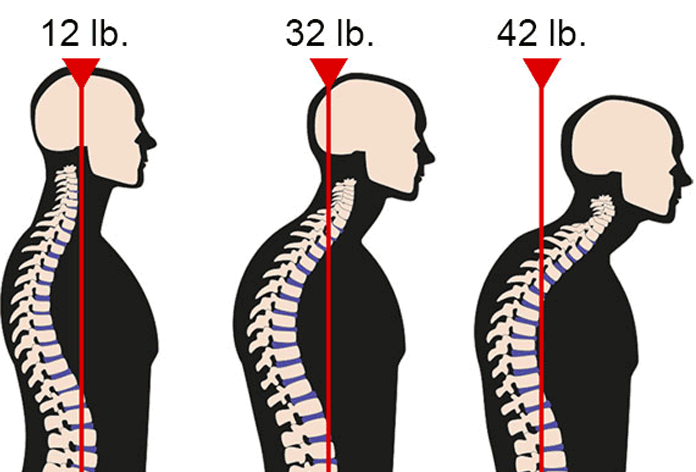 Forward Head Posture Fix Reviews | Is It Worth Buying